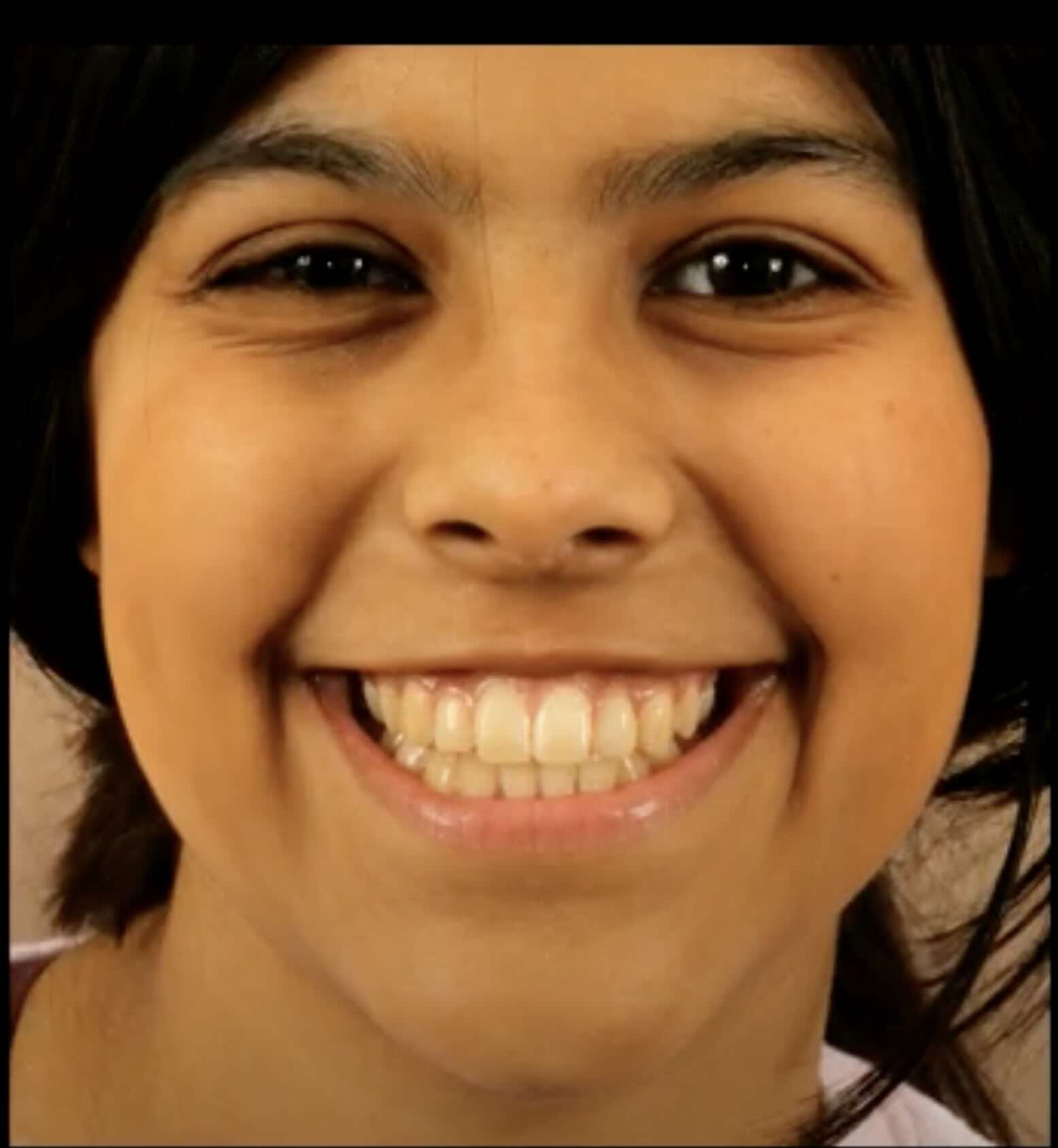 Birmingham AL | Sarver Orthodontics | Invisalign Braces » Sarver ...